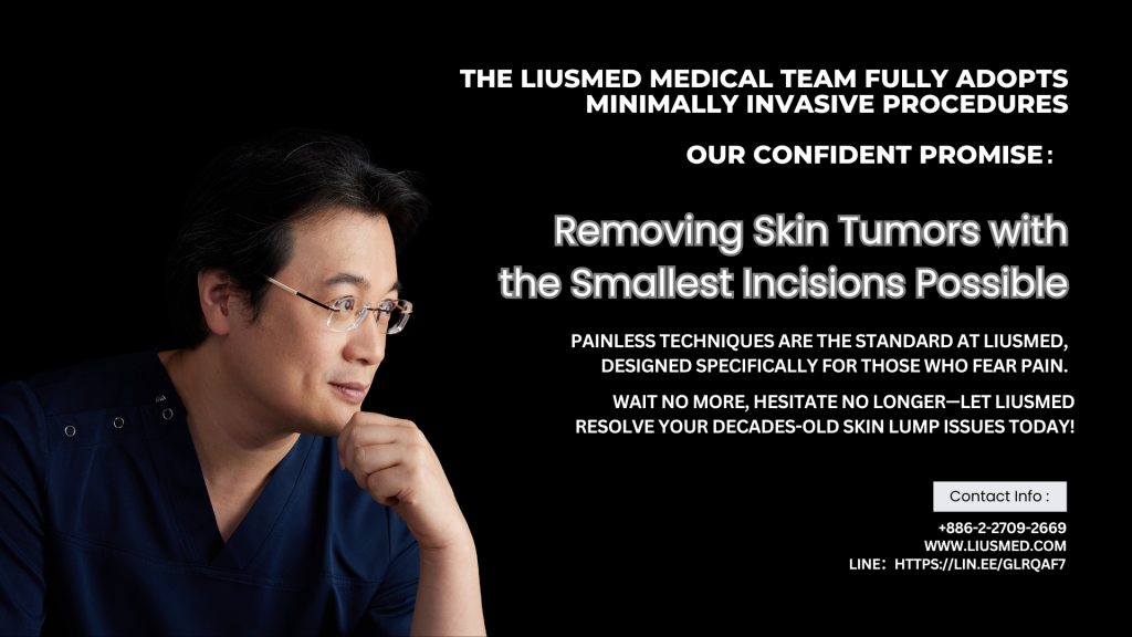 Removal of 15 cm Back Lipoma | Lipoma Surgery Record. Lipoma and ...